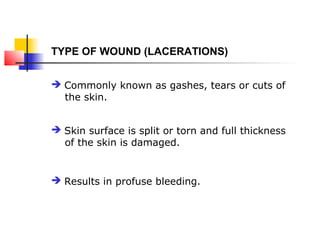 Sec1.fa4 wounds & bleeding | PPT