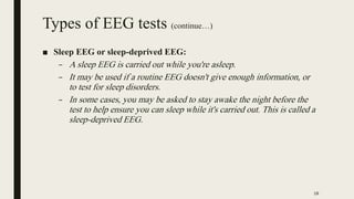 Sec 2 eeg | PDF