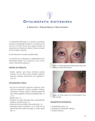 Sección 2. órbita y vías lagrimales | PDF