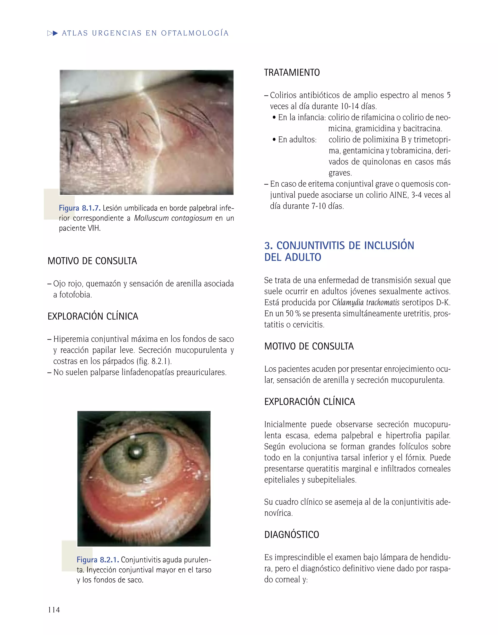 Sección 3. párpados, conjuntiva y esclera | PDF | Eye and Vision ...