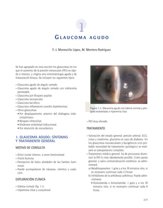 Sección 6. glaucoma e hipertensión ocular | PDF