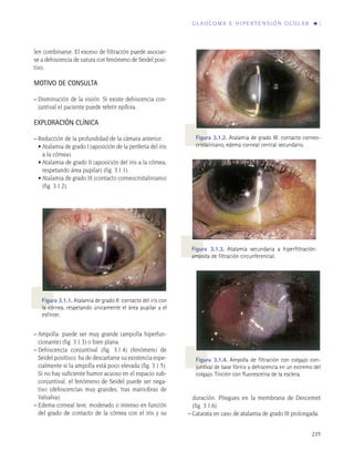 Sección 6. glaucoma e hipertensión ocular | PDF