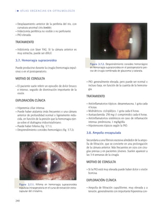 Sección 6. glaucoma e hipertensión ocular | PDF
