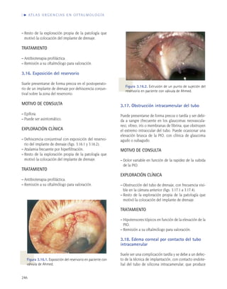 Sección 6. glaucoma e hipertensión ocular | PDF