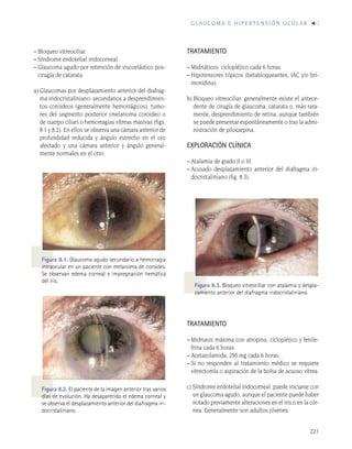 Sección 6. glaucoma e hipertensión ocular | PDF