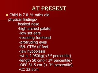 Seckle Syndrome | PPSX