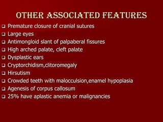 Seckle Syndrome | PPSX