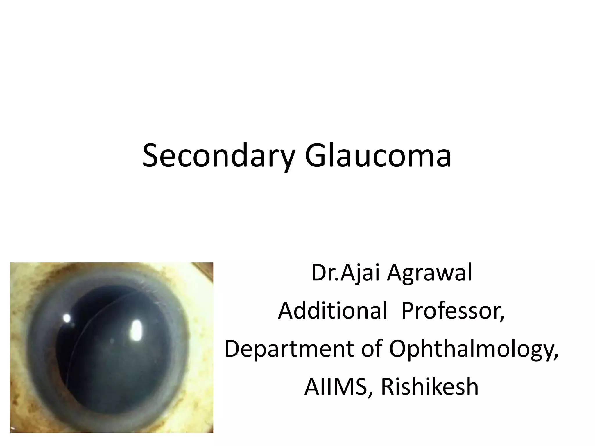 Secondary-glaucoma-Final.pptx