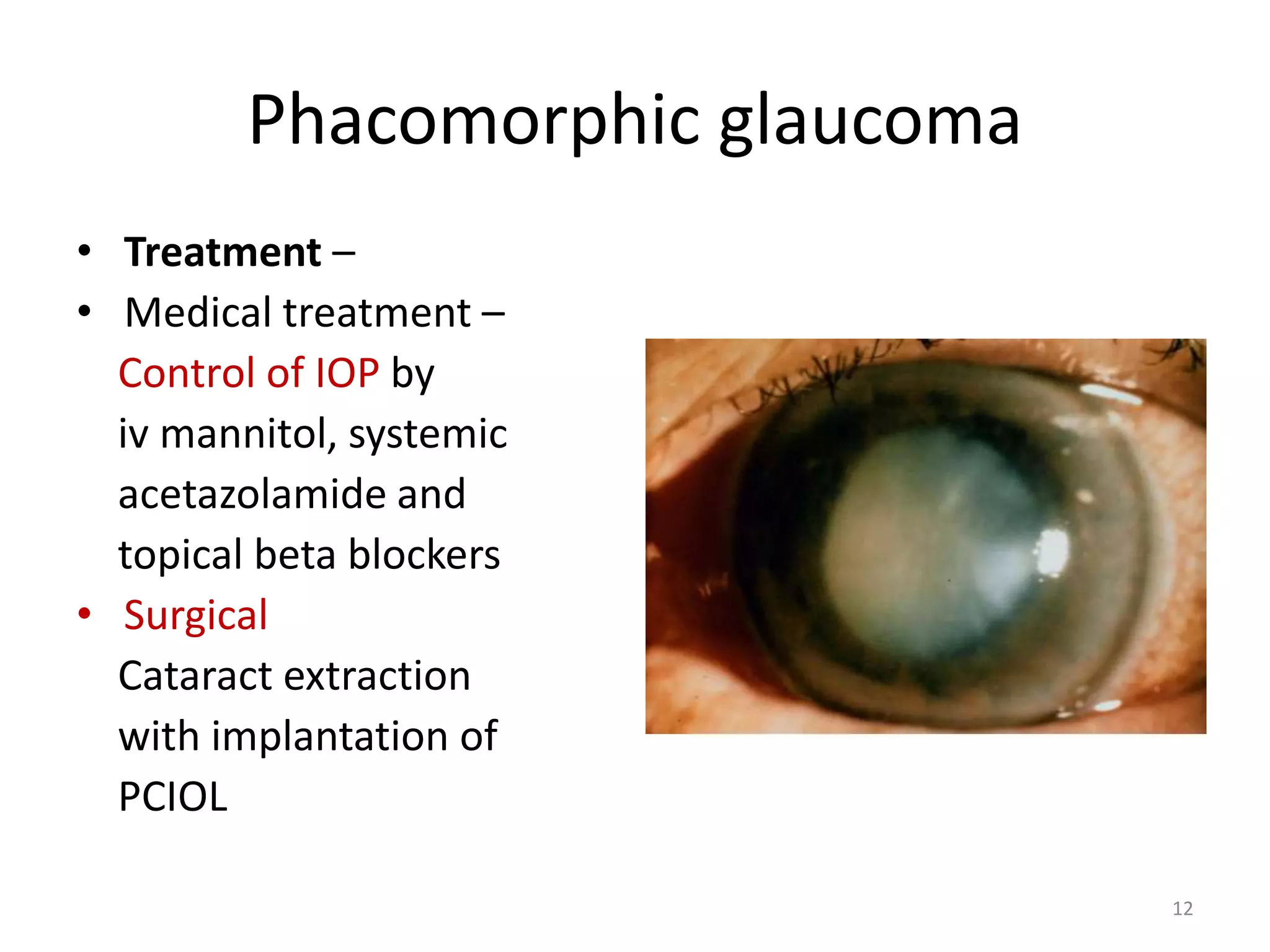 Secondary-glaucoma-Final.pptx