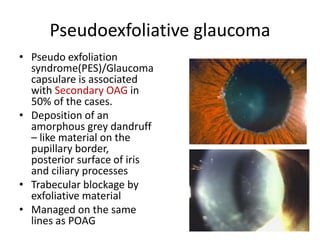 Secondary-glaucoma-Final.pptx