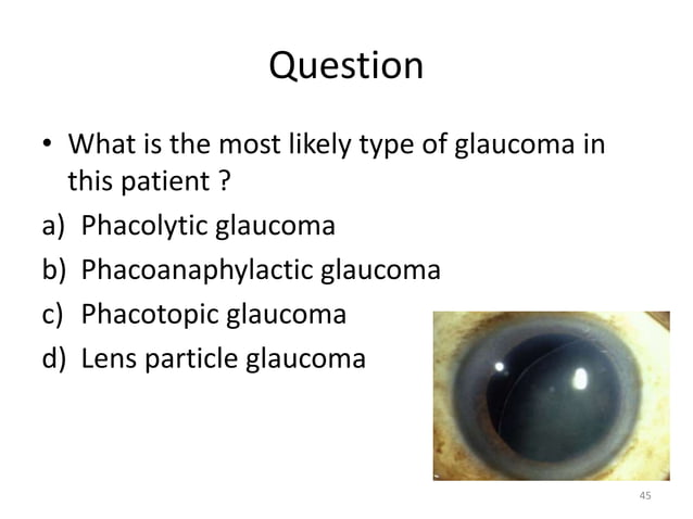 Secondary-glaucoma-Final.pptx | Eye and Vision Conditions | Diseases and Conditions