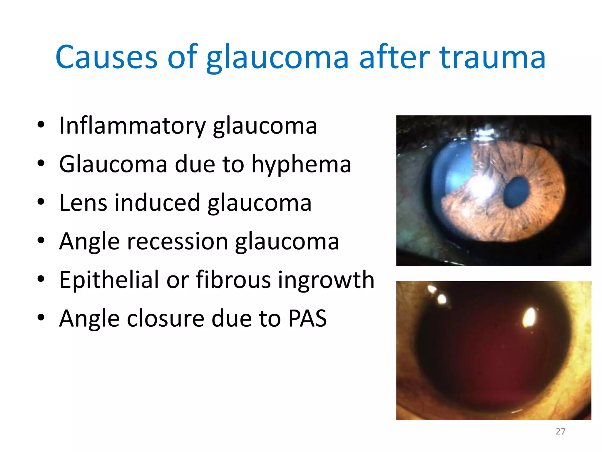 Secondary-glaucoma-Final.pptx