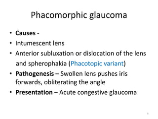 Secondary-glaucoma-Final.pptx