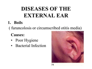 Common Ear Diseases | PDF