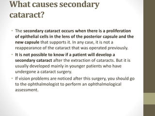 Secondary cataract | PPTX