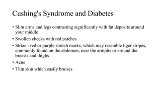 Secondary diabetes | PPTX