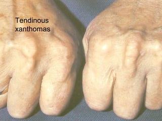 Secondary dyslipidemia | PPT