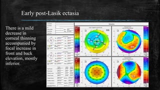 Secondary Corneal Ectasia.pptx | Eye and Vision Conditions | Diseases ...
