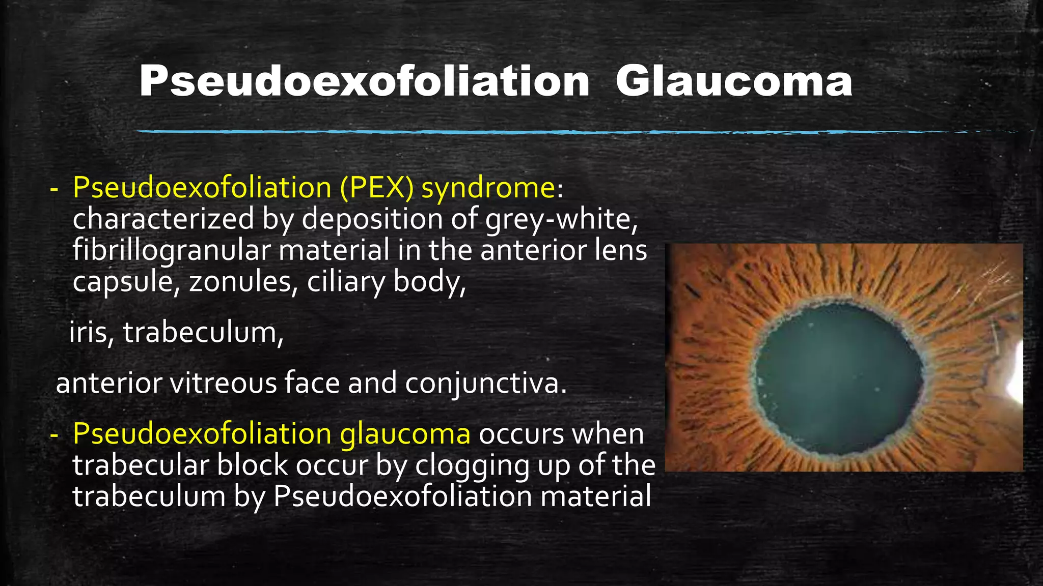 Secondary glaucoma | PPTX