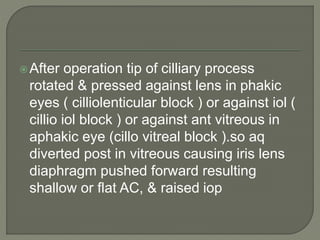 Secondary Glaucoma.pptx