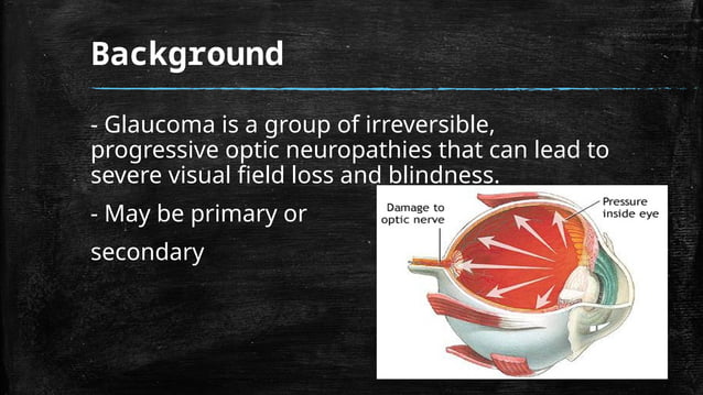 Secondary glaucoma an overview about glaucoma | PPTX