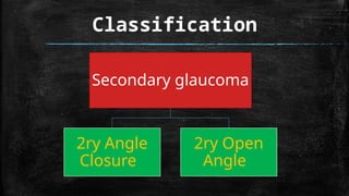 Secondary glaucoma an overview about glaucoma | PPTX