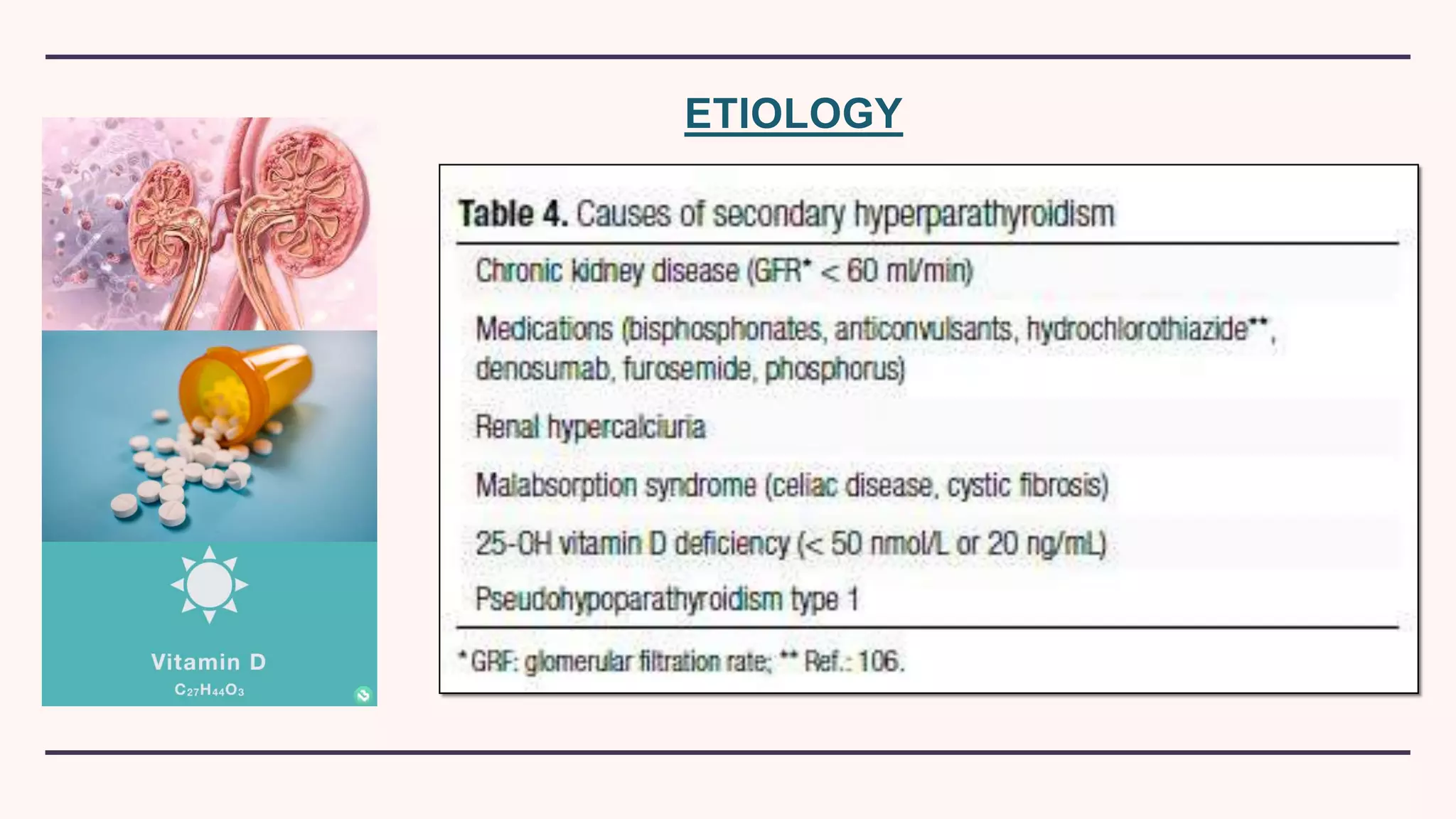 Secondary Hyperparathyroidism | PPTX | Endocrine and Metabolic Diseases ...