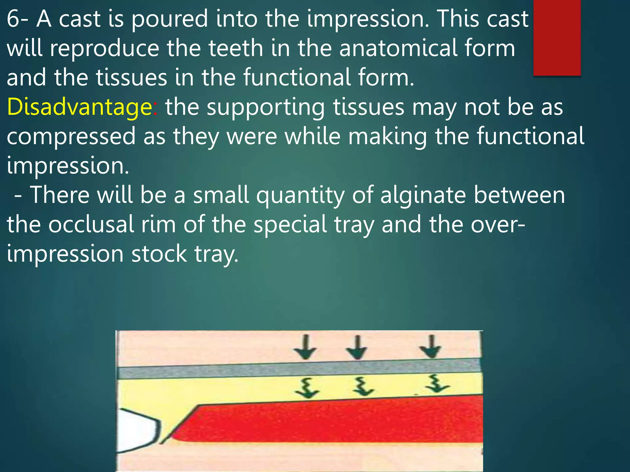 Secondary impression and master cast for RPD (0).pptx