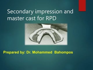 Secondary impression and master cast for RPD (0).pptx