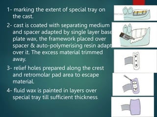 Secondary impression and master cast for RPD (0).pptx