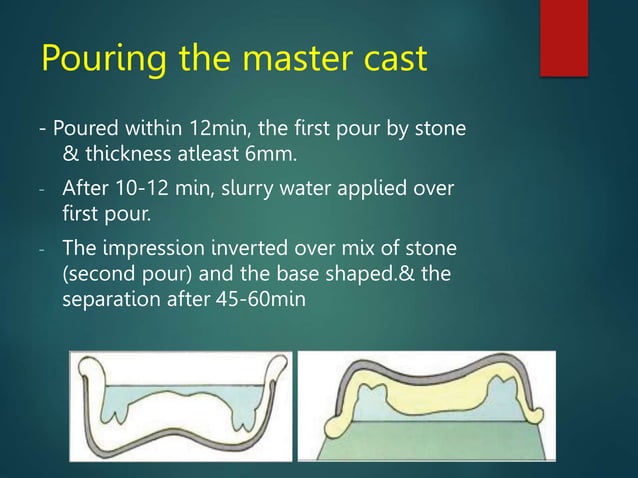 Secondary impression and master cast for RPD (0).pptx | Dental Health ...