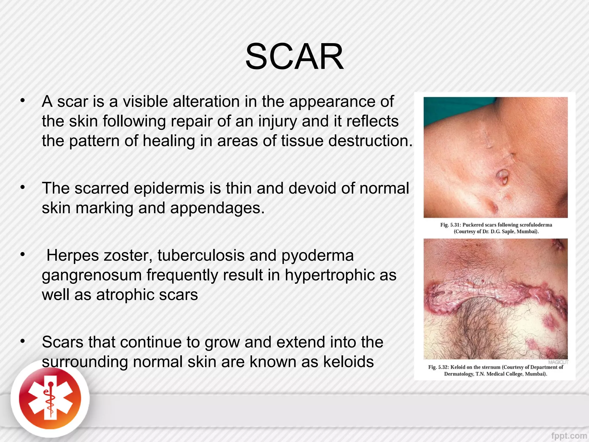 Secondary lesions & Special lesions in dermatology | PPT