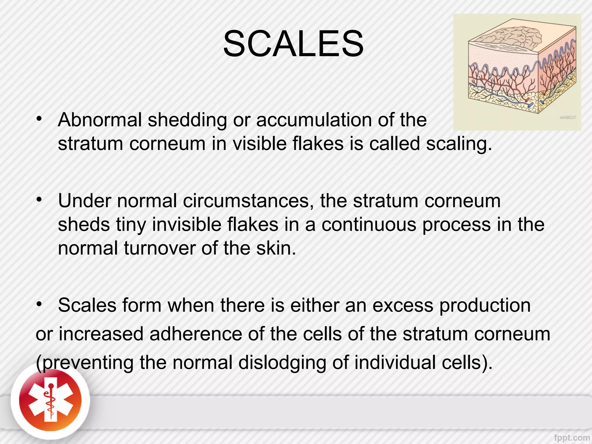Secondary lesions & Special lesions in dermatology | PPT