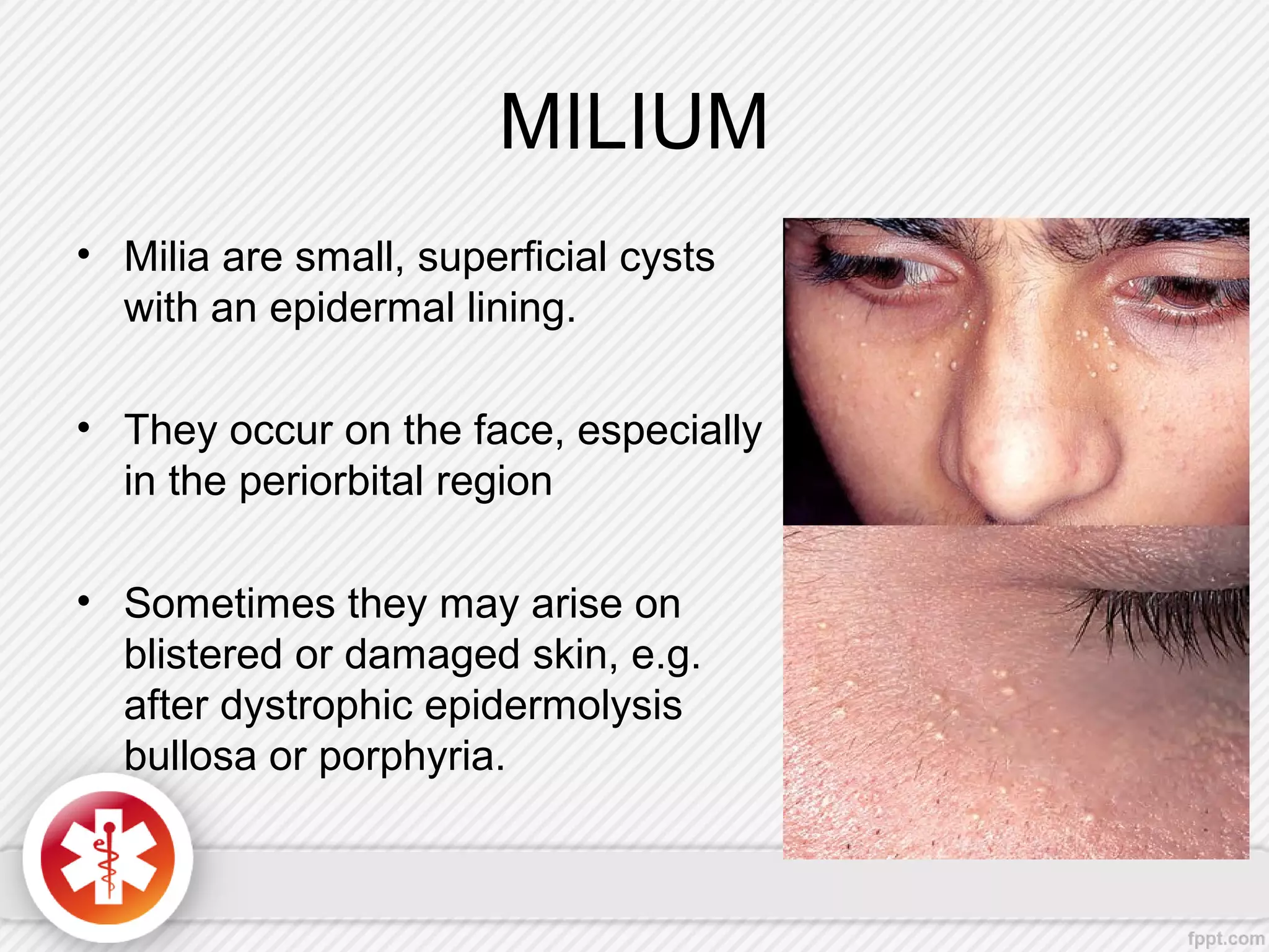 Secondary lesions & Special lesions in dermatology | PPT