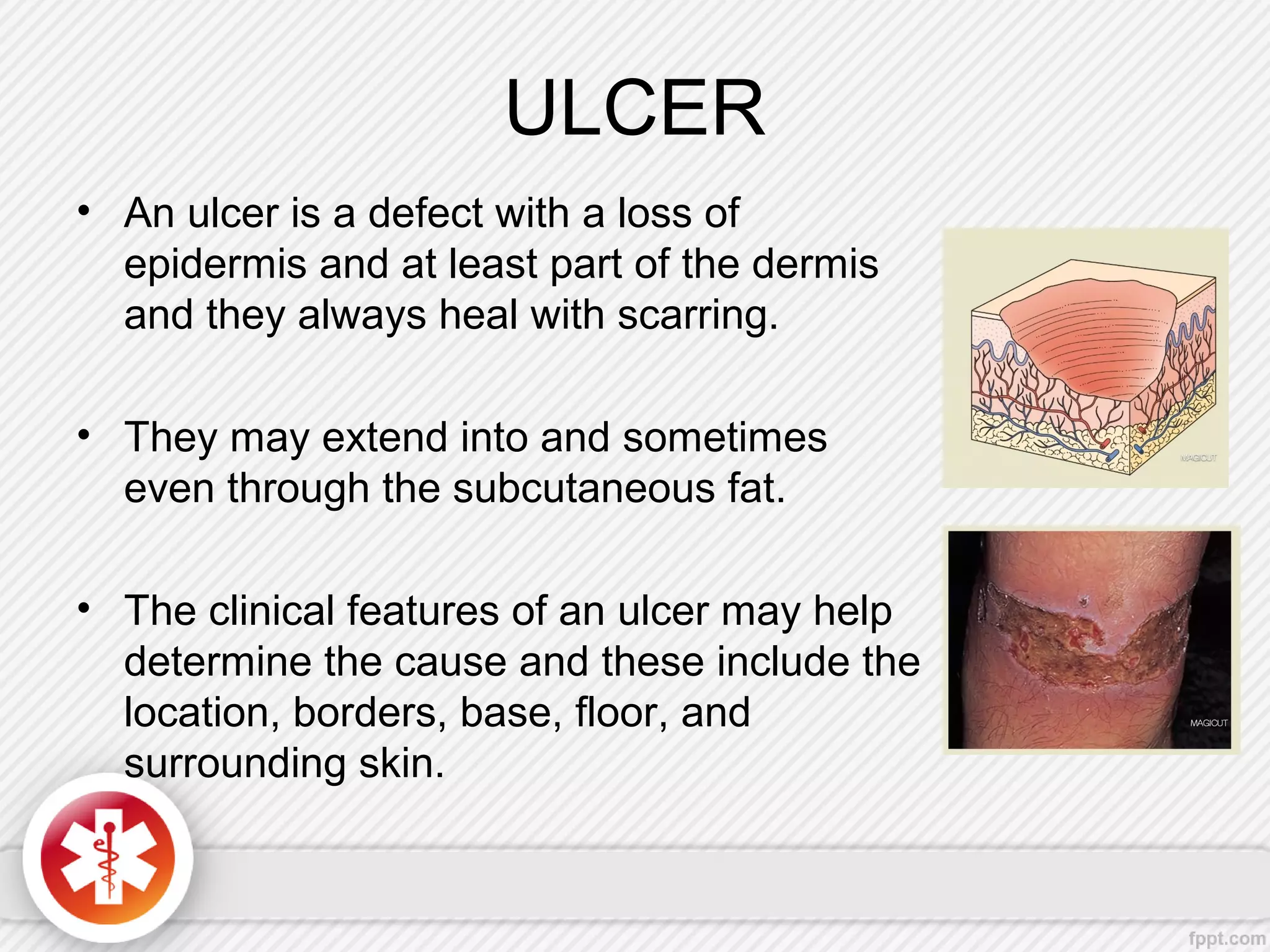 Secondary lesions & Special lesions in dermatology | PPT
