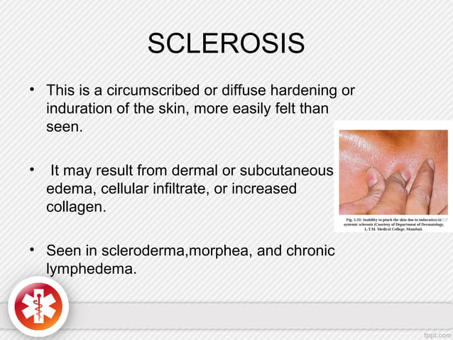 Secondary lesions & Special lesions in dermatology | PPT | Skin and ...
