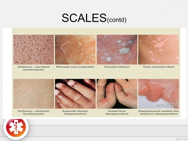 Secondary lesions & Special lesions in dermatology | PPT | Skin and ...