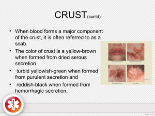 Secondary lesions & Special lesions in dermatology | PPT
