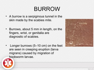 Secondary lesions & Special lesions in dermatology | PPT | Skin and ...