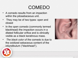 Secondary lesions & Special lesions in dermatology | PPT