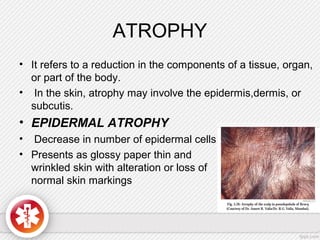 Secondary lesions & Special lesions in dermatology | PPT | Skin and ...