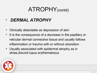Secondary lesions & Special lesions in dermatology | PPT | Skin and ...
