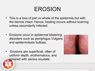 Secondary lesions & Special lesions in dermatology | PPT