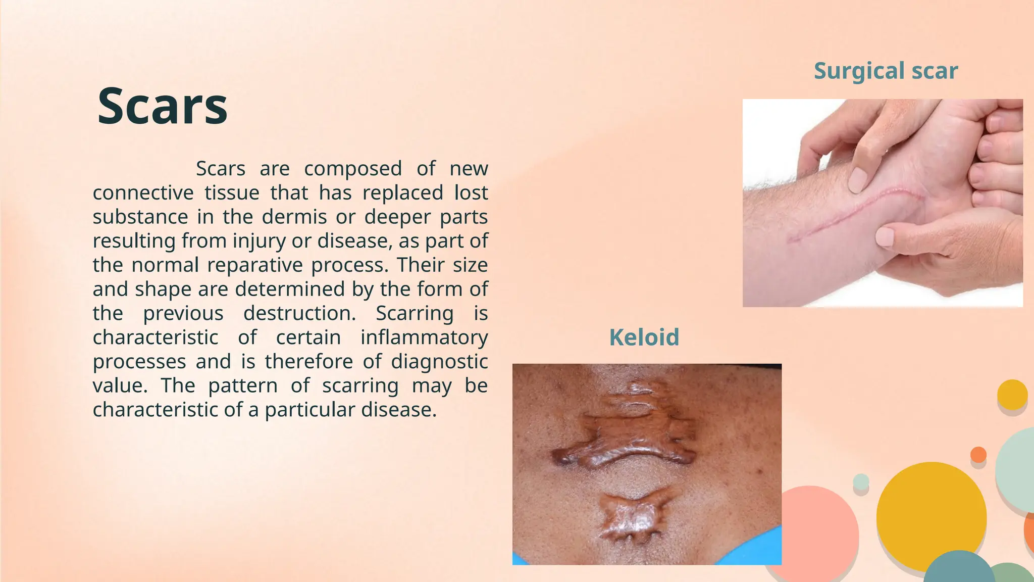 DERMATOLOGY SKIN PIGMENT Secondary Lesions.pptx