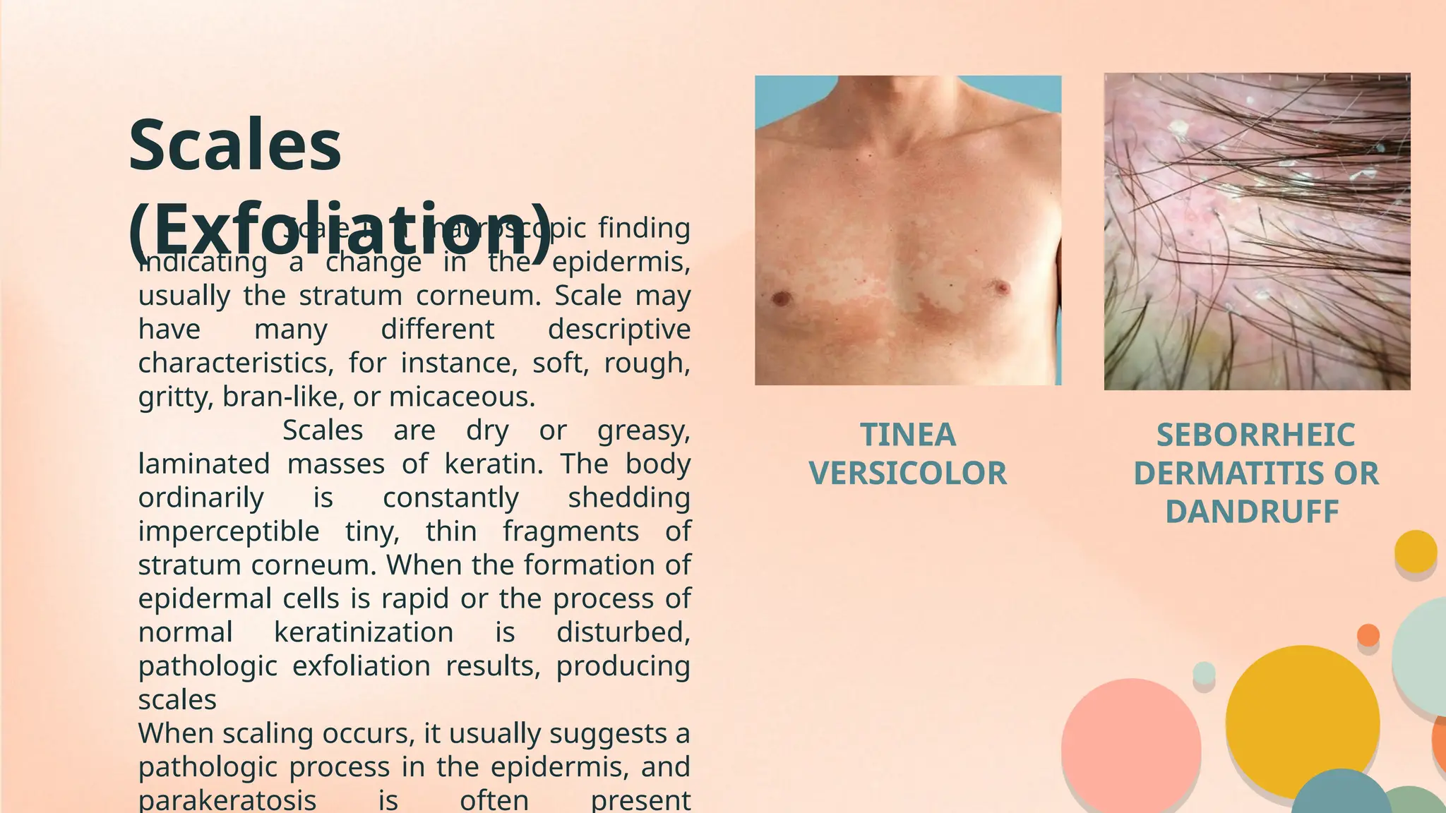 DERMATOLOGY SKIN PIGMENT Secondary Lesions.pptx