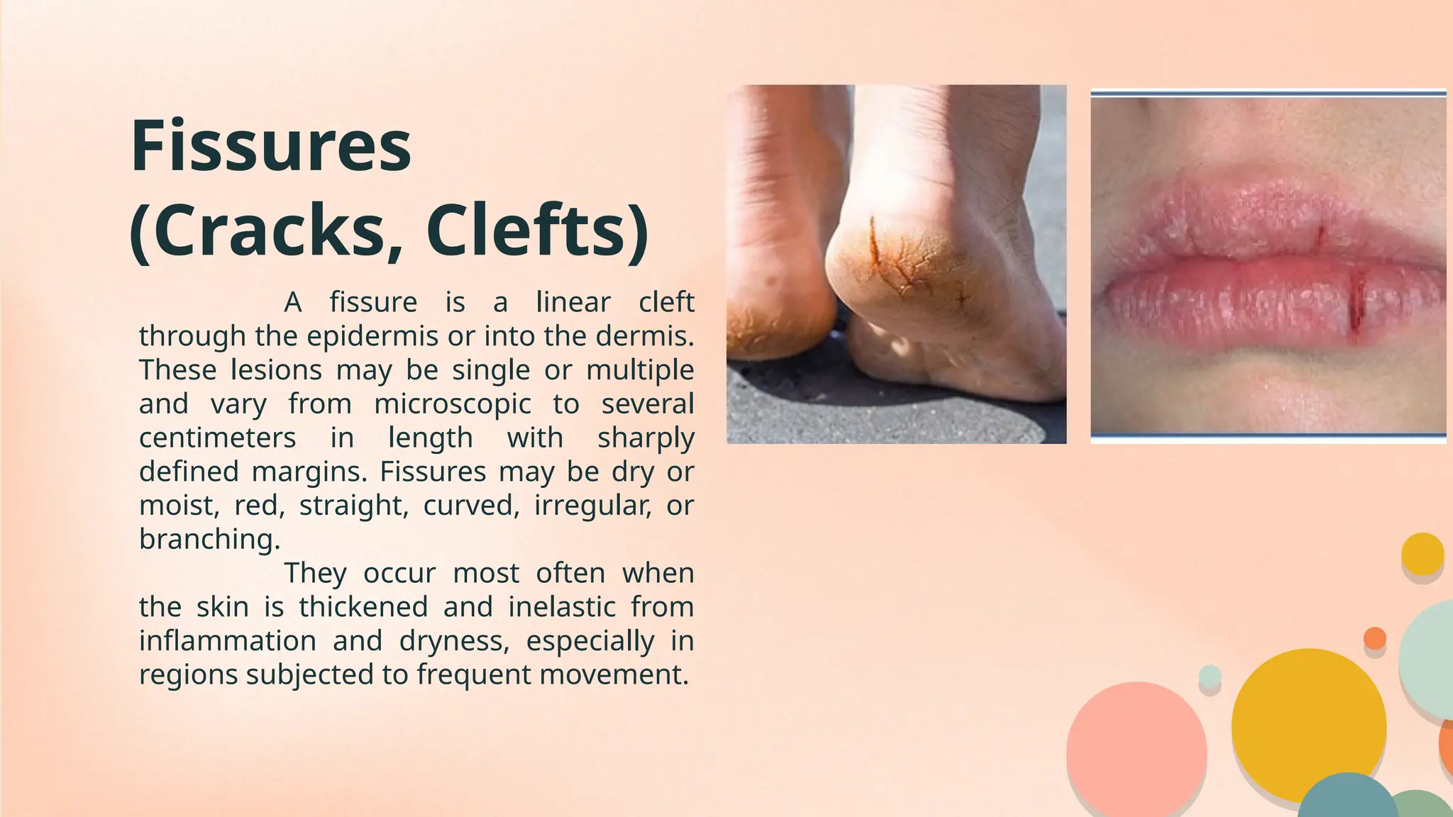 DERMATOLOGY SKIN PIGMENT Secondary Lesions.pptx