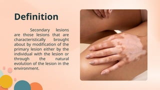 DERMATOLOGY SKIN PIGMENT Secondary Lesions.pptx