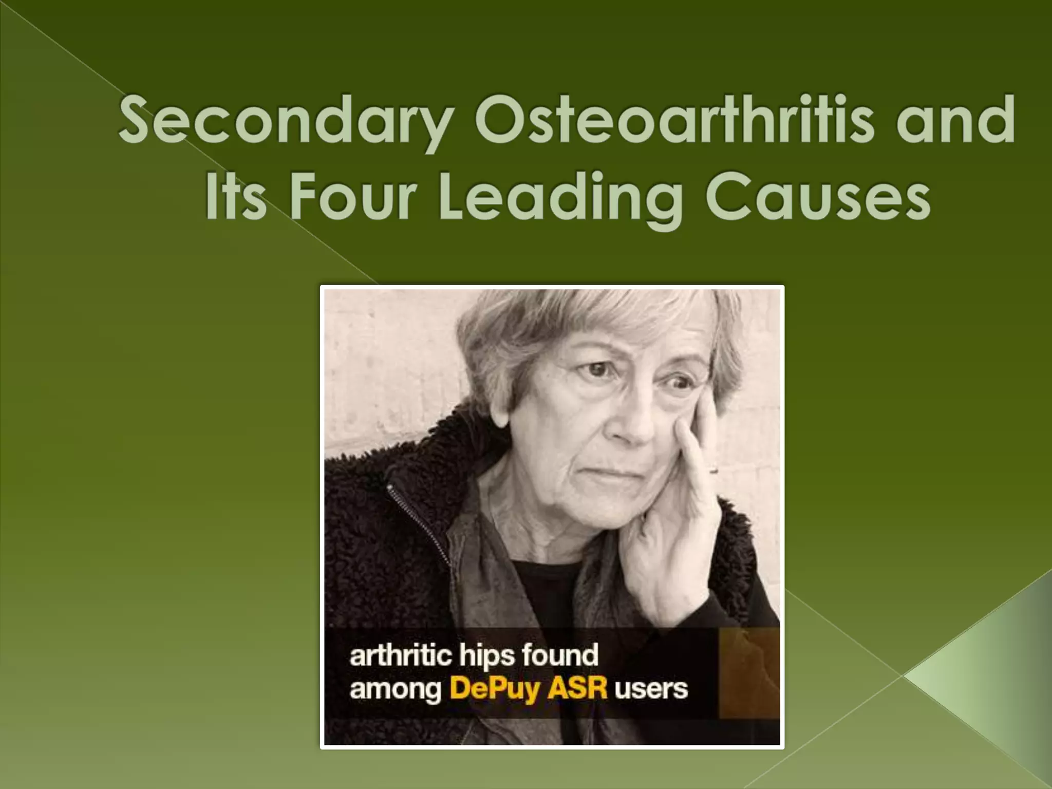 Secondary osteoarthritis and its four leading causes | PPT