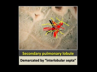 Primary Pulmonary Lobule
