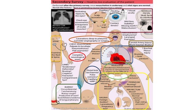 Secondary survey in trauma | PPTX